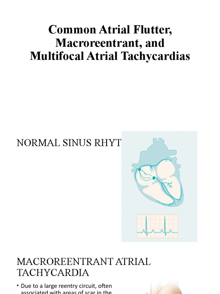 Arrhythmia | PDF