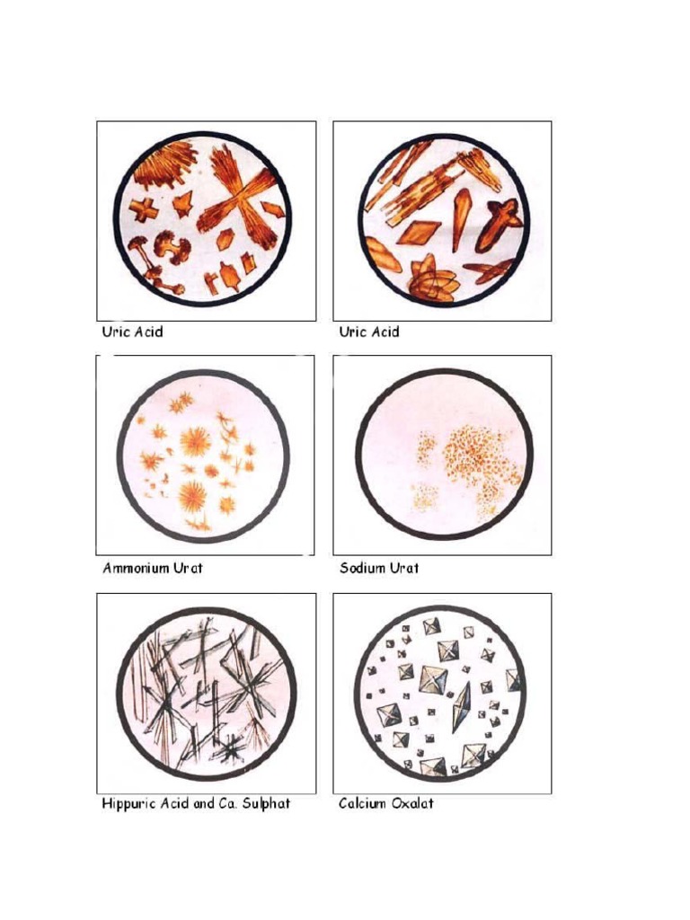 Sedimen Urine.1 | PDF