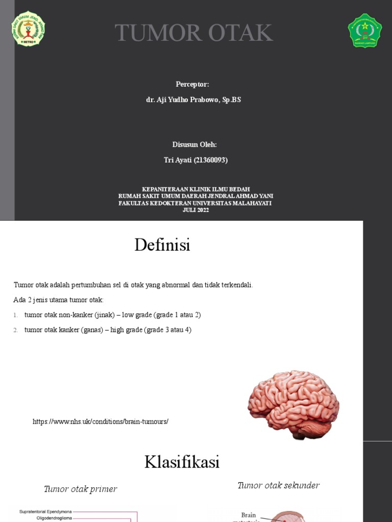 Tumor Otak | PDF