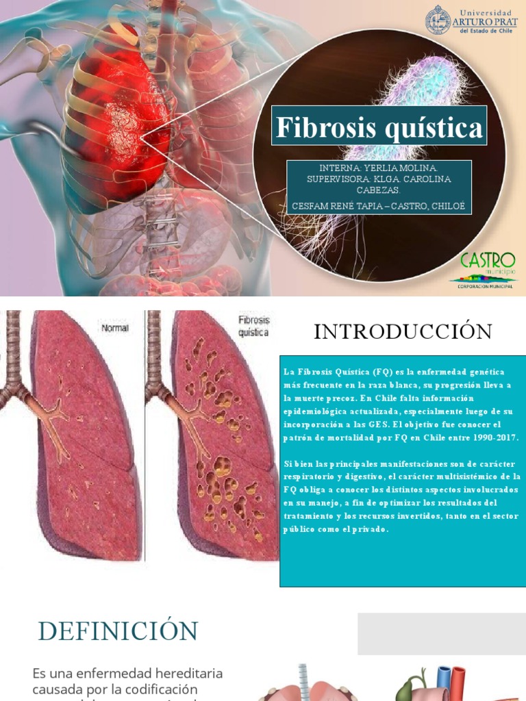 Fibrosis Quistica 7ma Presentacion | PDF | Ciencias de la Salud ...