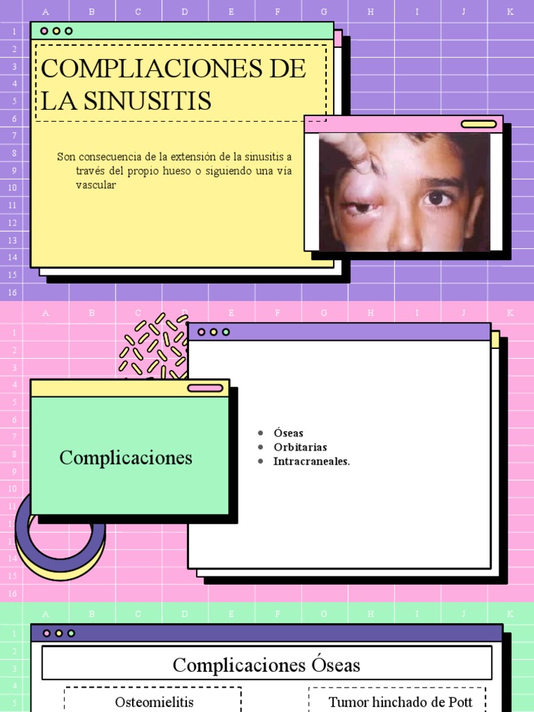 Complicaciones de La Sinusitis | PDF