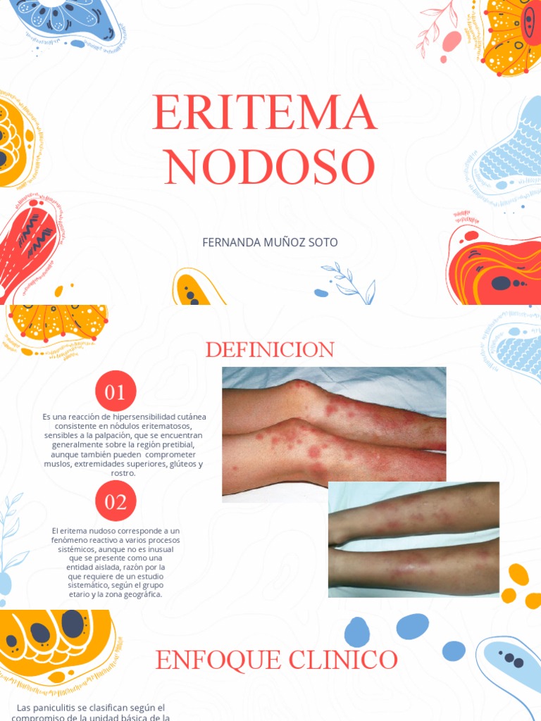 Eritema Nodoso | PDF | Ciencias de la Salud | Medicina CLINICA
