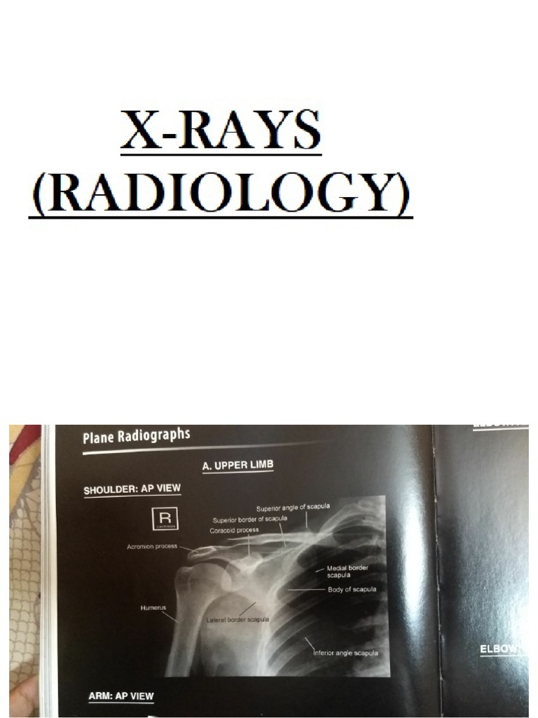 X-Ray Johari MBBS Lectures | PDF