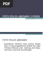 Definisi dan Penyebab Meteorismus | PDF | Kesehatan Holistik