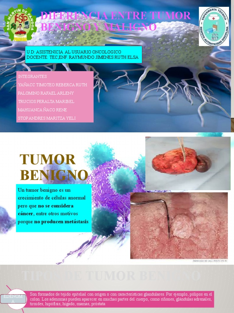 Diferencia Entre Tumor Benigno y Maligno | PDF