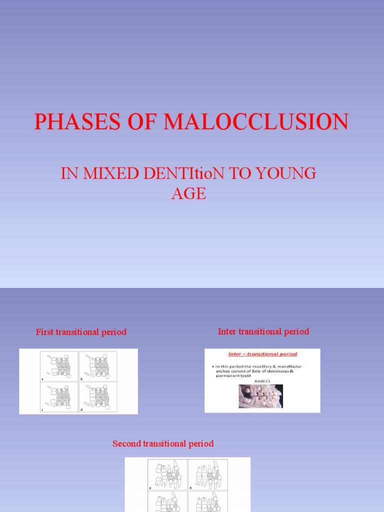 Phases of Malocclusion | PDF