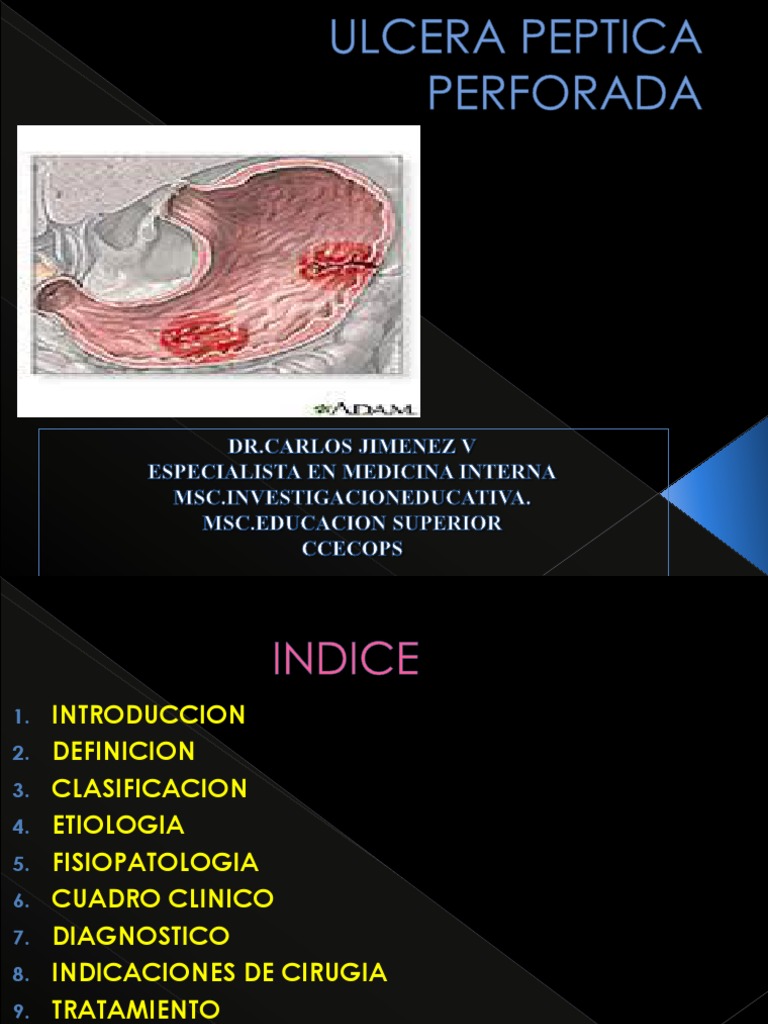 Ulcera Peptica Perforada | PDF | Medicina | Causas de la muerte