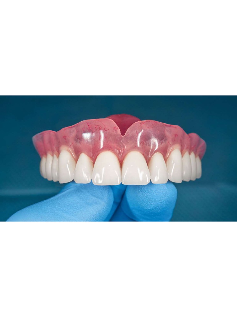 Proteza Totala | PDF