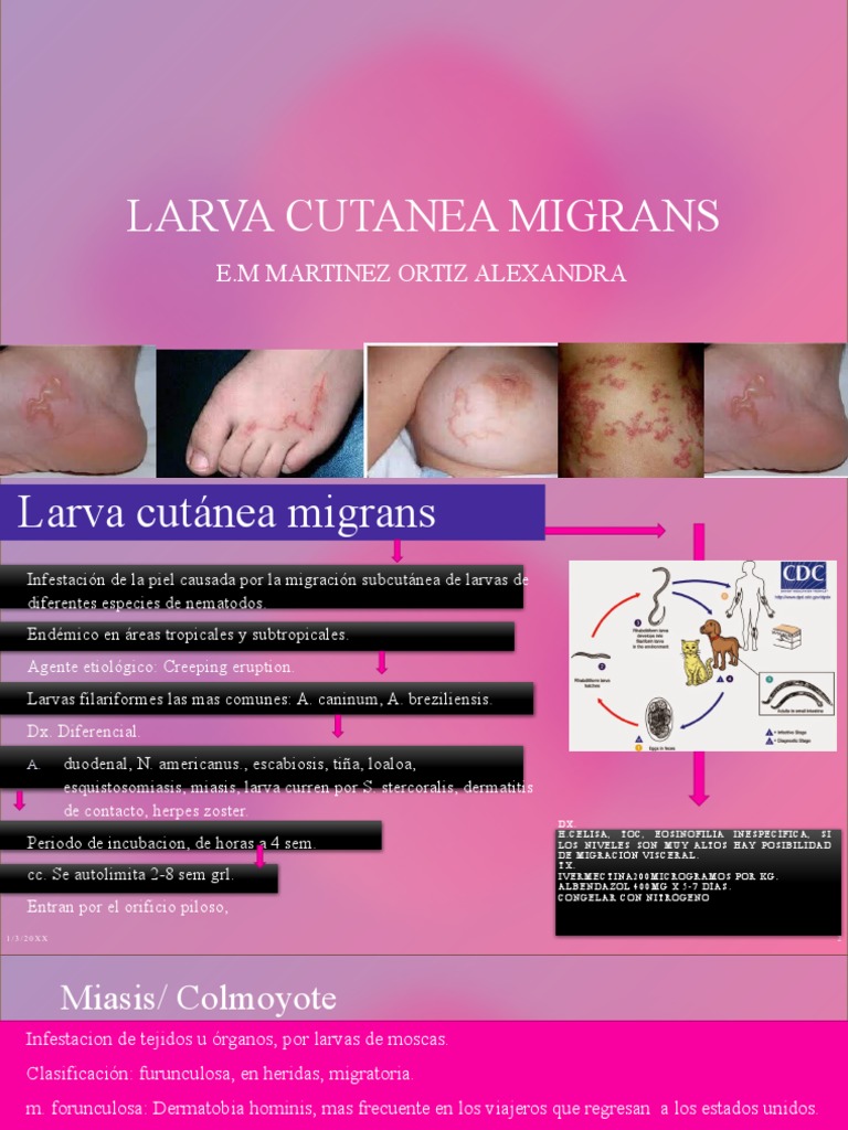 Tipos De Larva Migrans _ Larva Migrans – XCTF