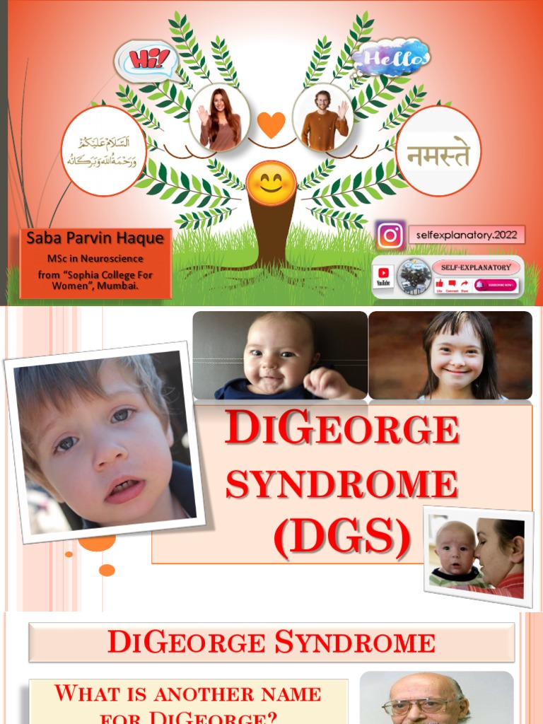 DiGeorge Syndrome (DGS) | PDF | Genetics | Epidemiology