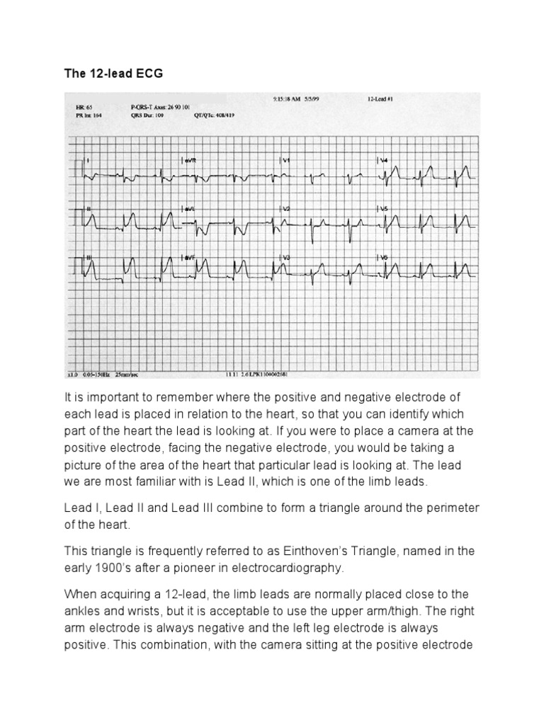 The 12 Lead Ecg Handout | PDF | Electrocardiography | Thorax (Human ...