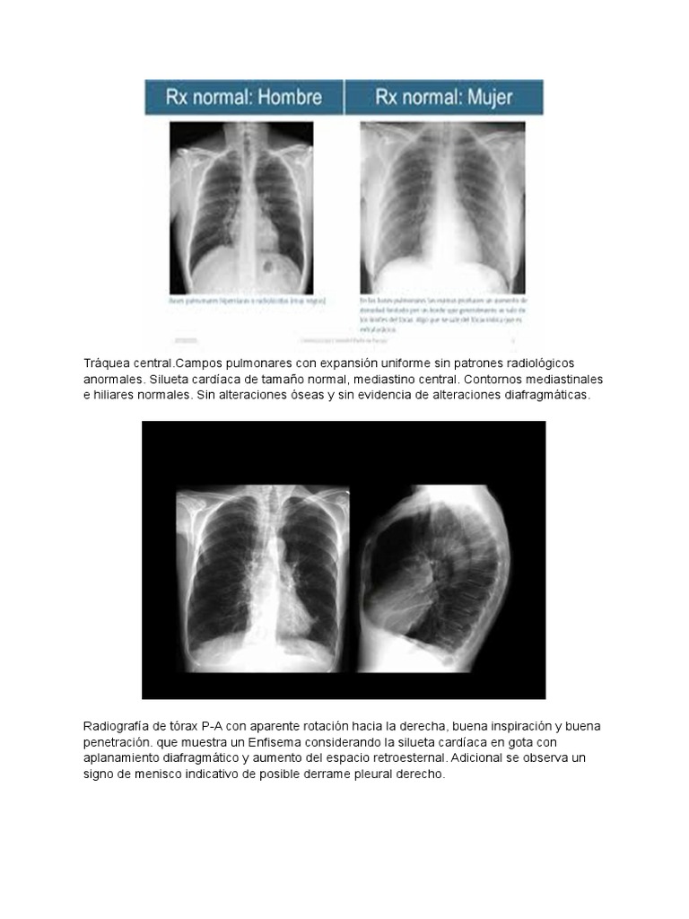 RX Imagenes | PDF | Pulmón | Especialidades Medicas
