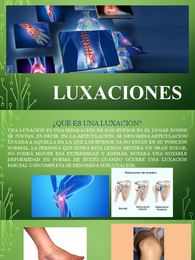 LUXACIONES | PDF | Rodilla | Lesión