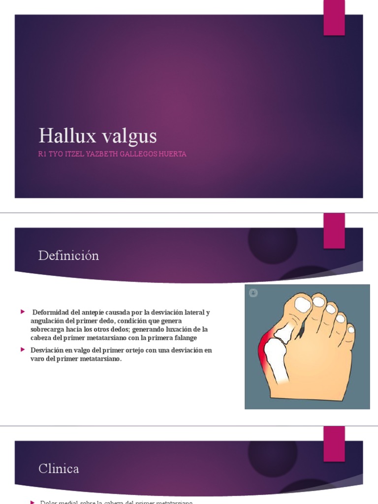 Hallux Valgus Pdf Dedo Del Pie Pie
