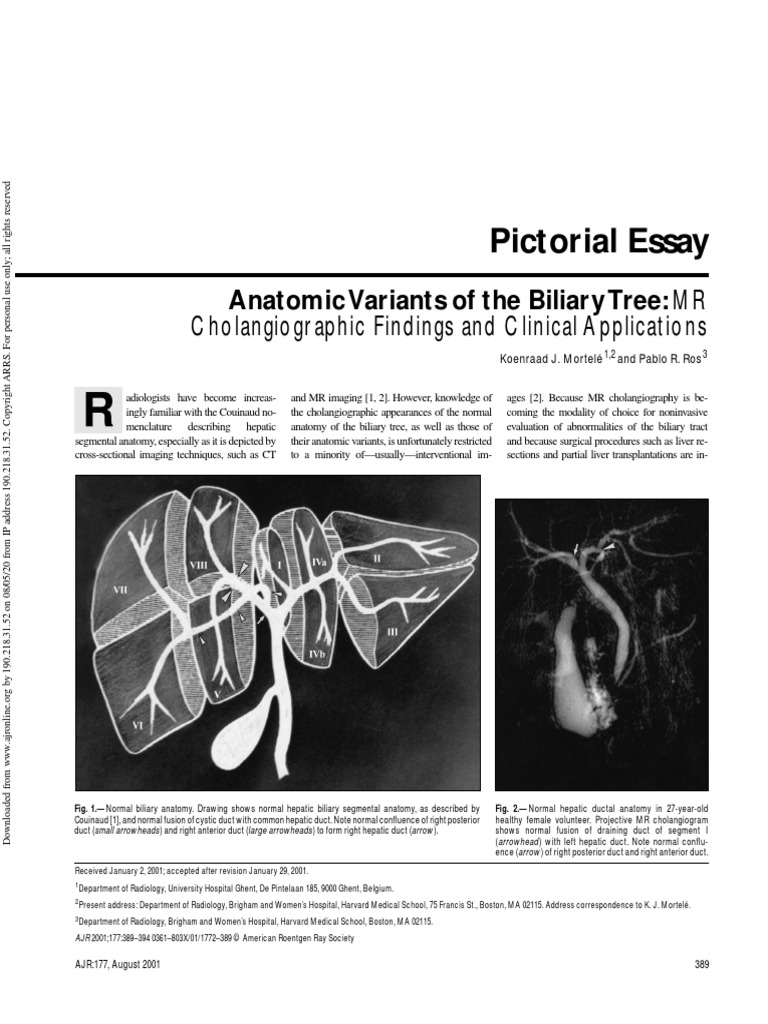 Anatomic Variants of The Biliary Tree | PDF | Liver | Anatomy