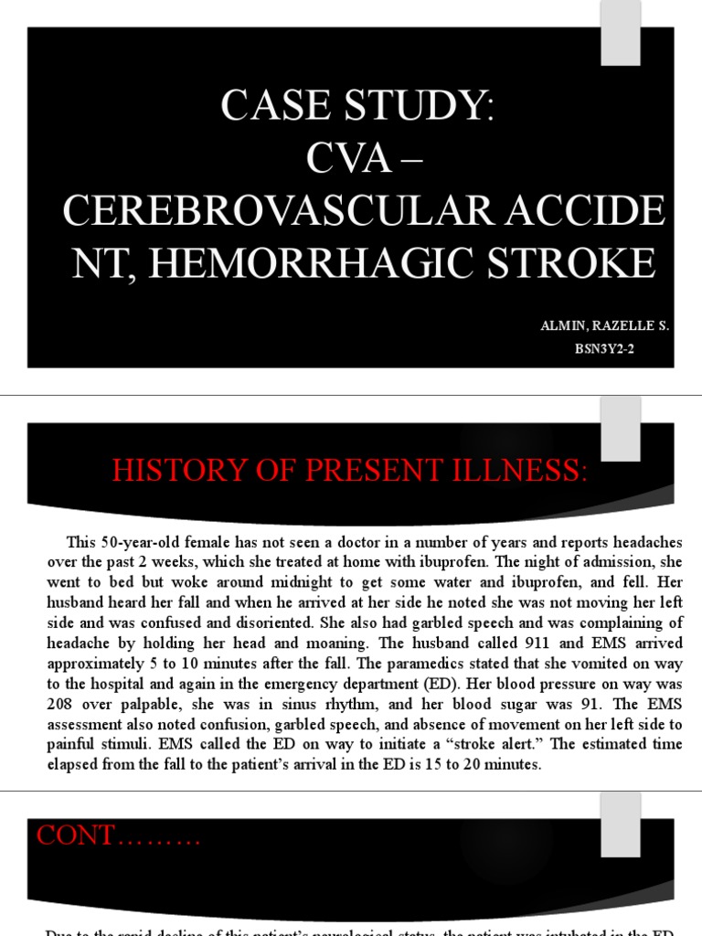 Case Study Cva | PDF | Stroke | Headache