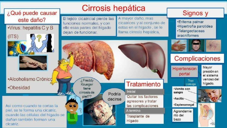 Cirrosis Hepatica Pdf