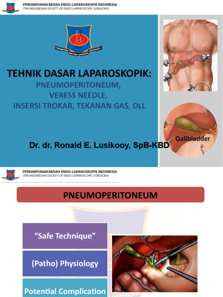 Tehnik Dasar Laparoskopik - Pneumoperatonium-Veress Needle | PDF ...