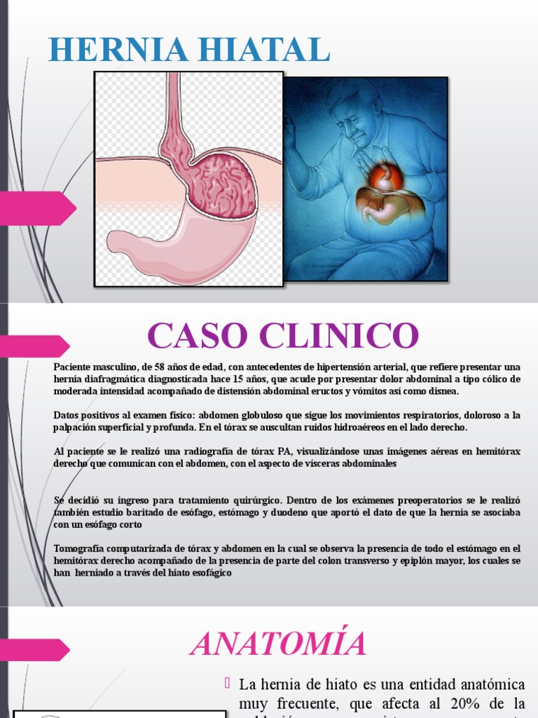 Hernia Hiatal | PDF | Abdomen | Especialidades Medicas