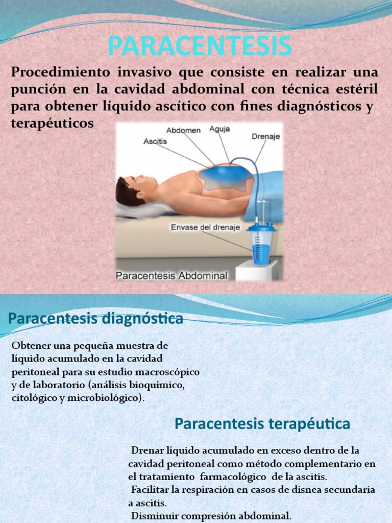 Paracentesis: Procedimiento y Cuidados | PDF | Especialidades Medicas ...