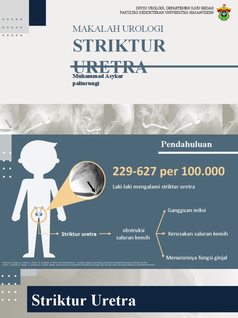 Striktur Uretra | PDF