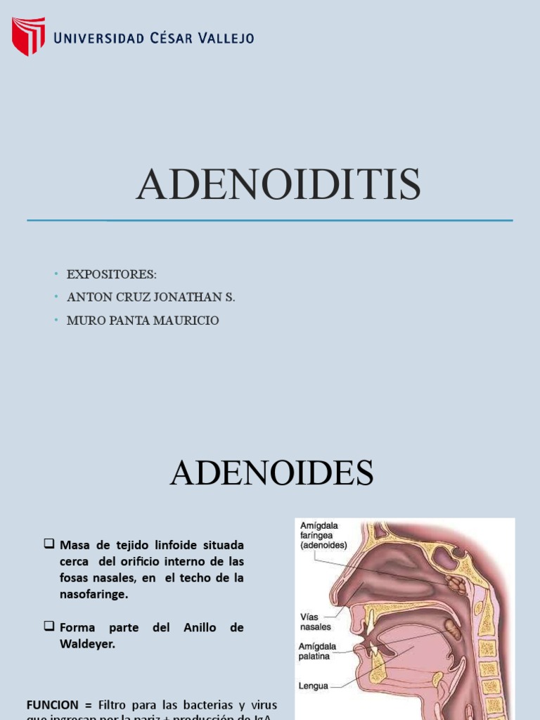 Adenoid It Is | PDF | Enfermedades respiratorias | Medicina CLINICA