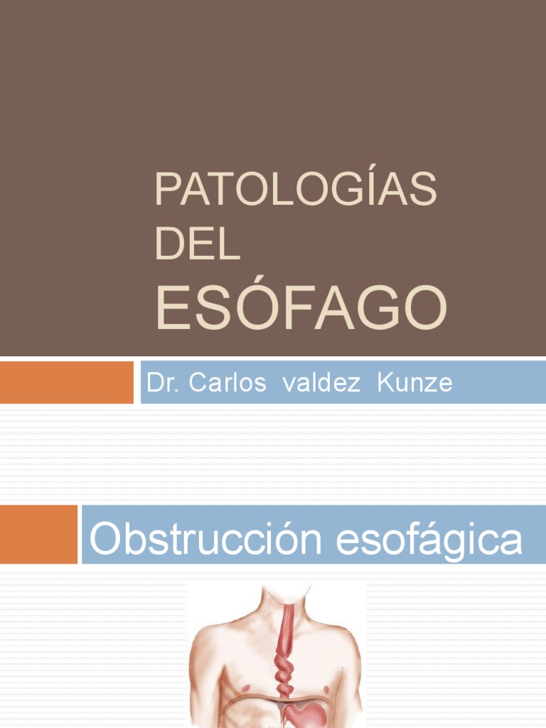 Patologia Esofago y Estomago | PDF | La enfermedad por reflujo ...