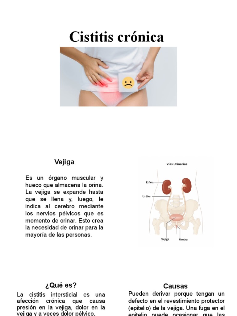 Cistitis Cronica | PDF | Vejiga urinaria | Infección del tracto urinario