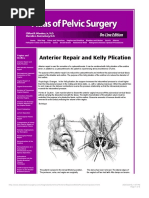 McCall Culdoplasty Procedure Overview | PDF | Vagina | Surgical Specialties