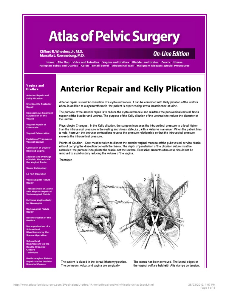 Anterior Repair and Kelly Plication | PDF | Vagina | Surgical Specialties