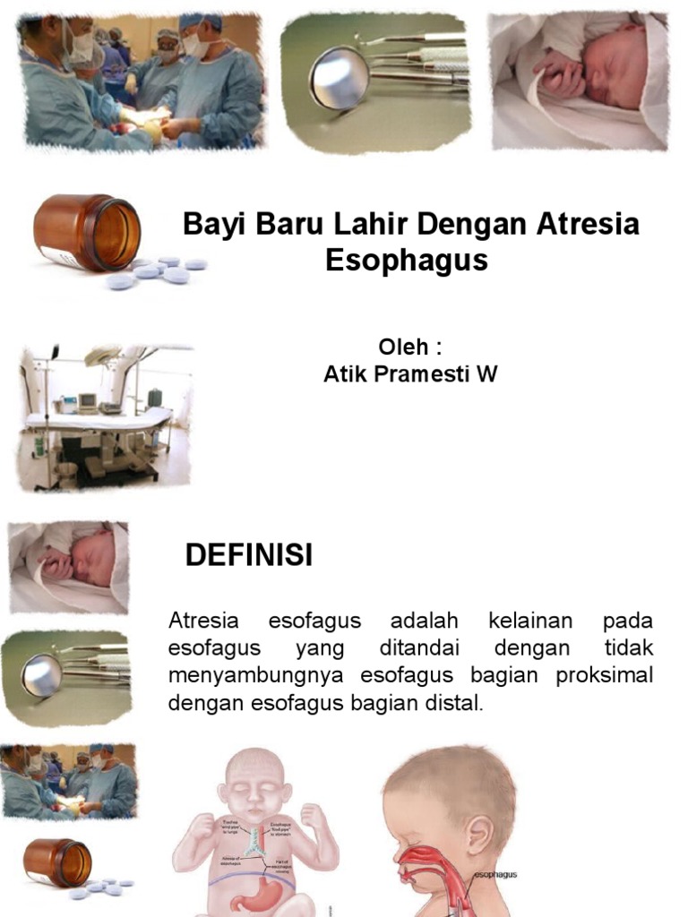 BBL Dengan Atresia Esofagus | PDF