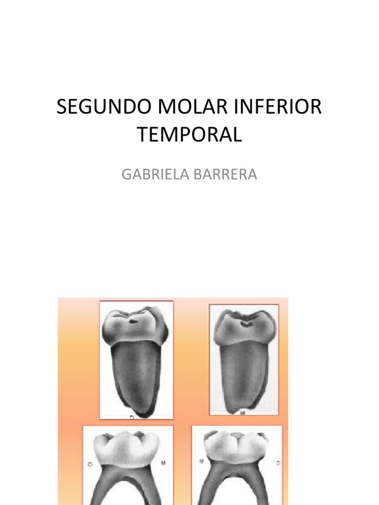 Segundo Molar Inferior Temporal | PDF