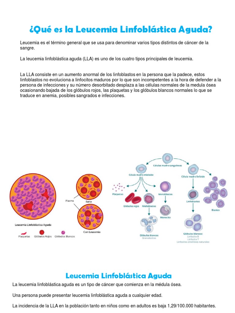 Leucemia Linfoblastica Aguda | PDF | Leucemia | Cáncer