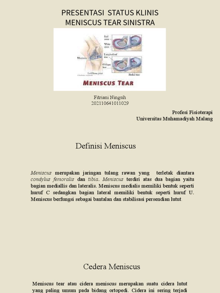 Meniscus Tear | PDF