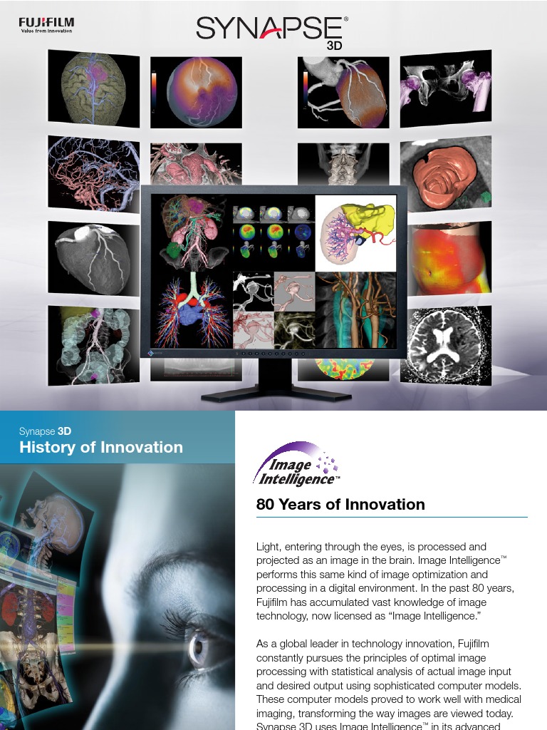 Synapse 3D Brochure - 1555316572 | PDF | 3 D Computer Graphics | Radiology