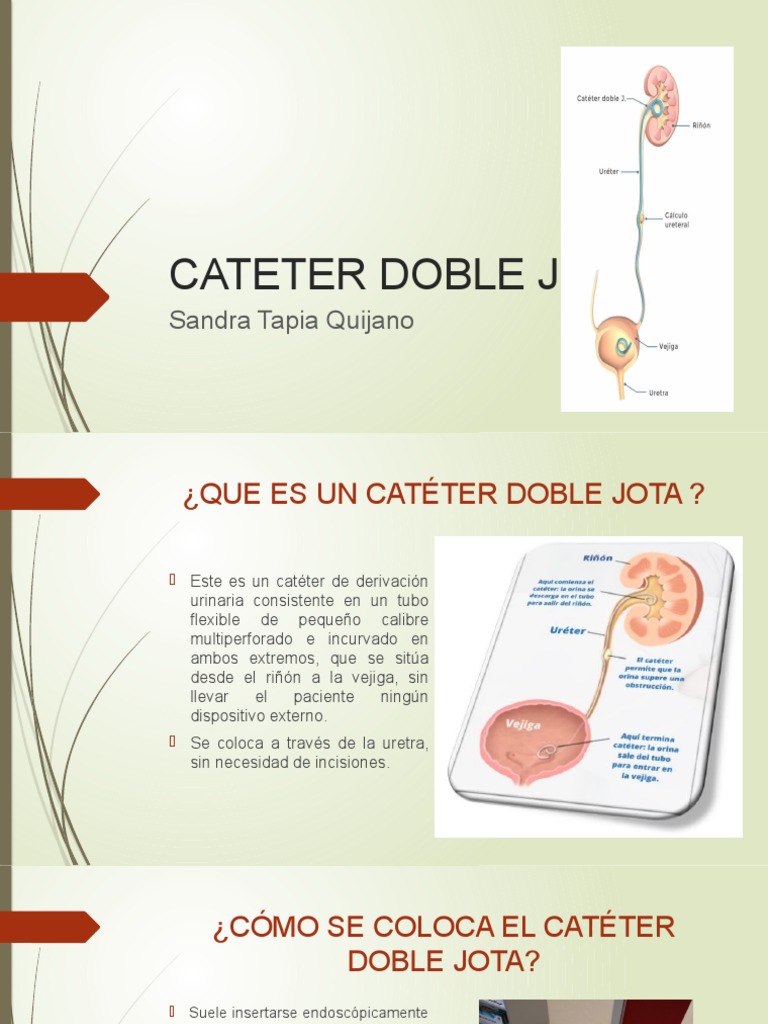 Cateter Doble Jota | PDF | Vejiga urinaria | Riñón
