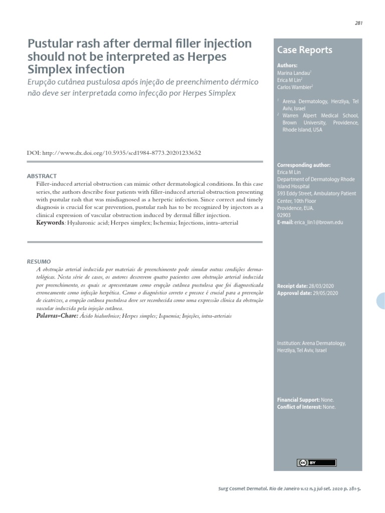 Pustular Rash After Dermal Filler Injection Should Not Be Interpreted As Herpes Simplex