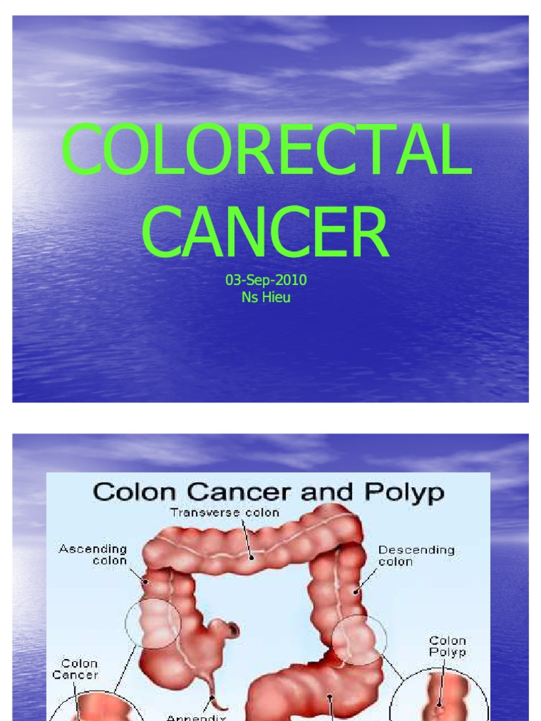 Colorectal Cancer | PDF | Colorectal Cancer | Cancer