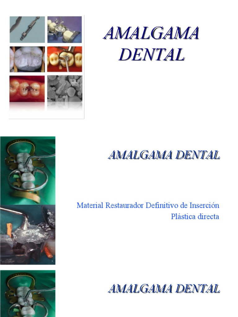 Amalgamas Dentales 2019 | PDF | Aleación | Mercurio (Elemento)