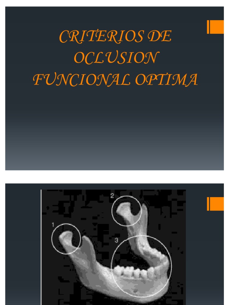 Criterios de Oclusion Funcional Optima | PDF