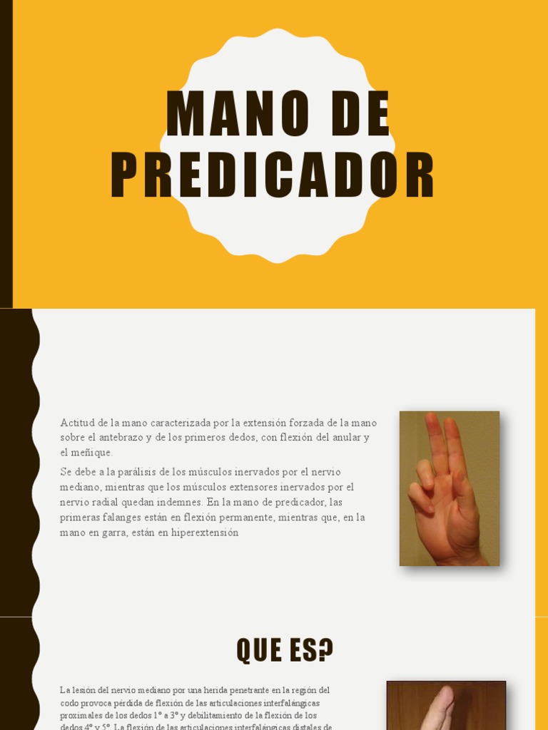 Mano de Predicador | PDF | Mano | Anatomía humana