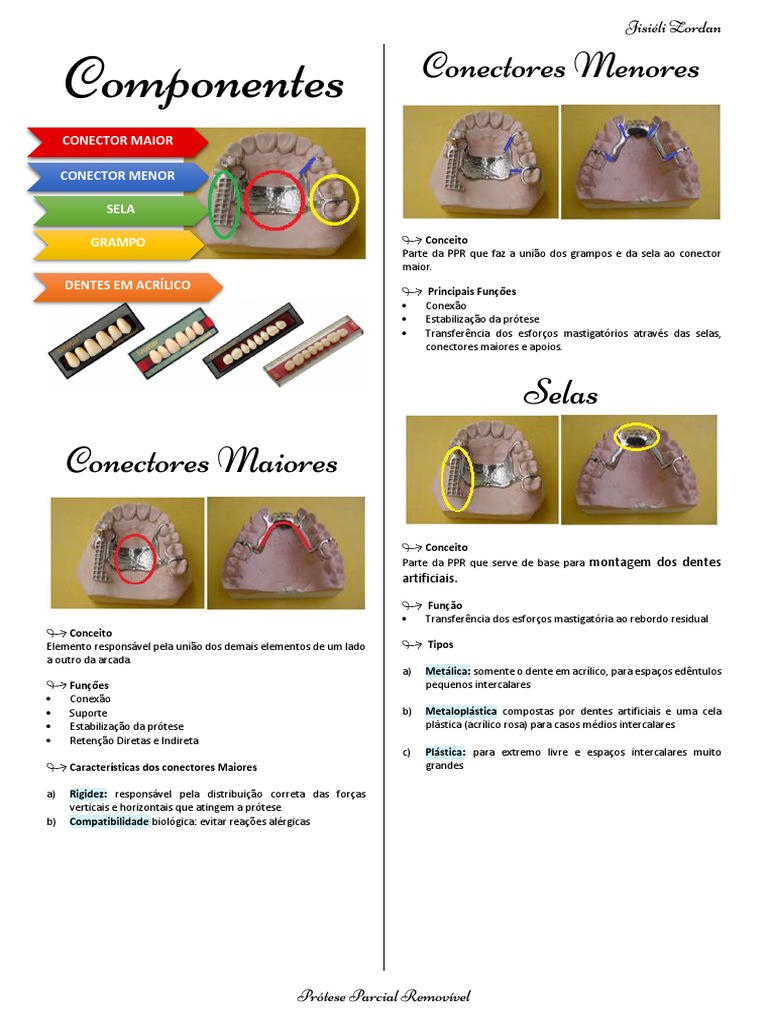 Componentes Da Prótese Parcial Removível | PDF | Dente | Prótese