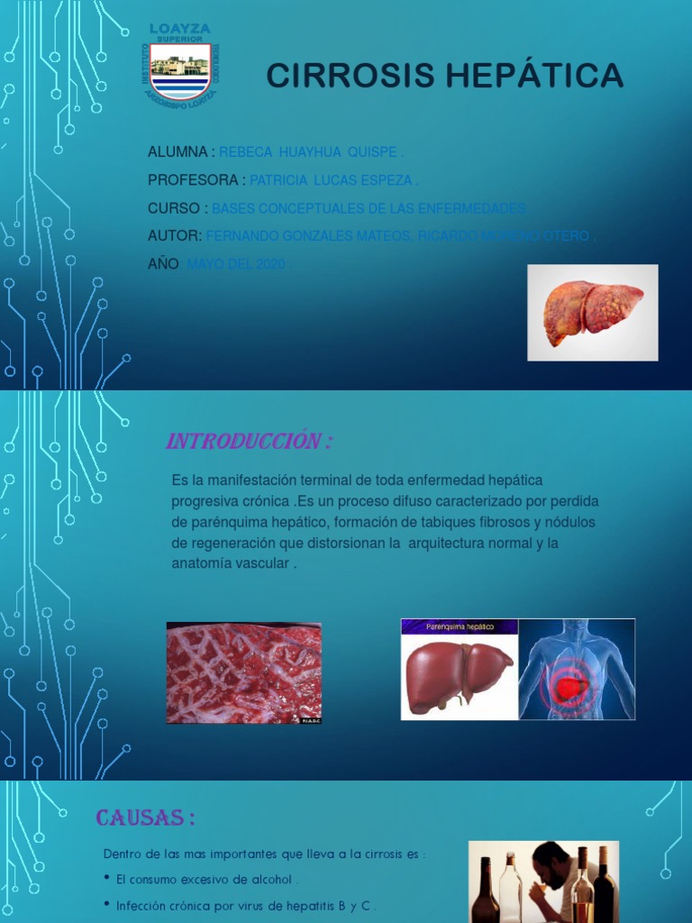 Cirrosis Hepática | PDF | Cirrosis | Hepatitis C