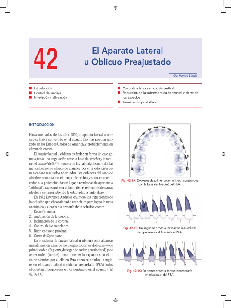 Aparato Lateral U Oblicuo Preajustado | PDF | Ortodoncia | Boca