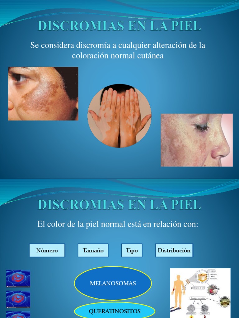 Modulo Iii Discromias y Acidos | PDF