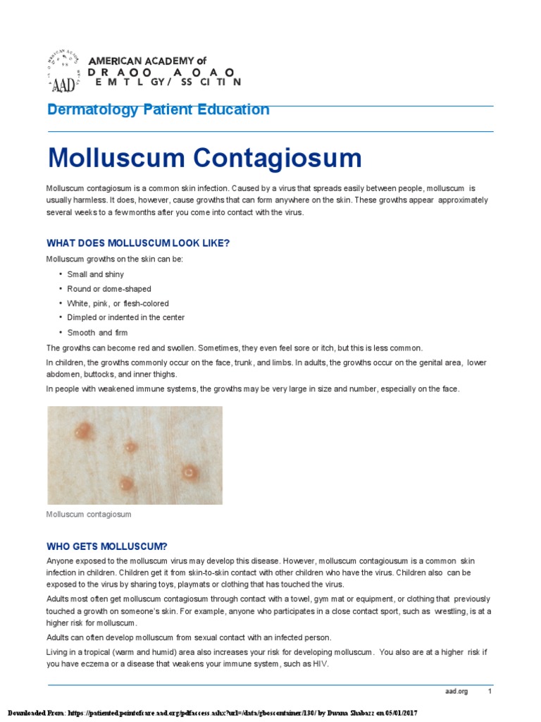Molluscum Contagiosum | PDF | Health Sciences | Dermatology