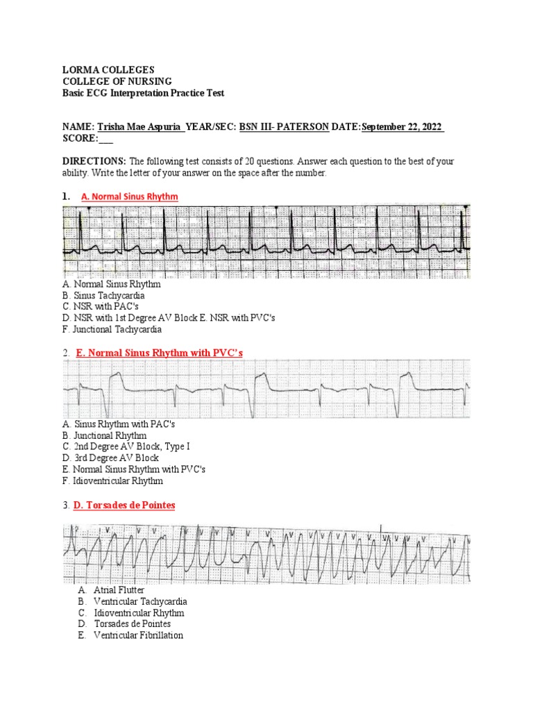 Sept 17 ECG Interpretation | PDF | Cardiovascular System | Clinical ...
