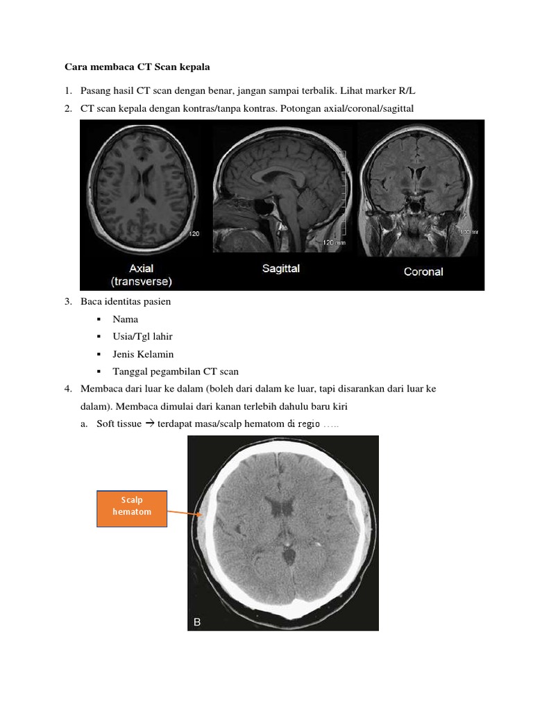 Panduan Membaca Hasil CT Scan Kepala | PDF | Kajian Bahasa Asing