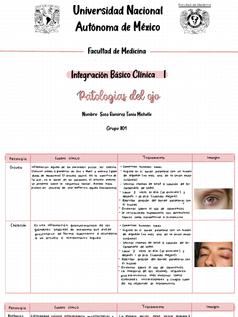 Patologías Del Ojo - Sosa Ramírez Tania Michelle | PDF | Enfermedades y ...