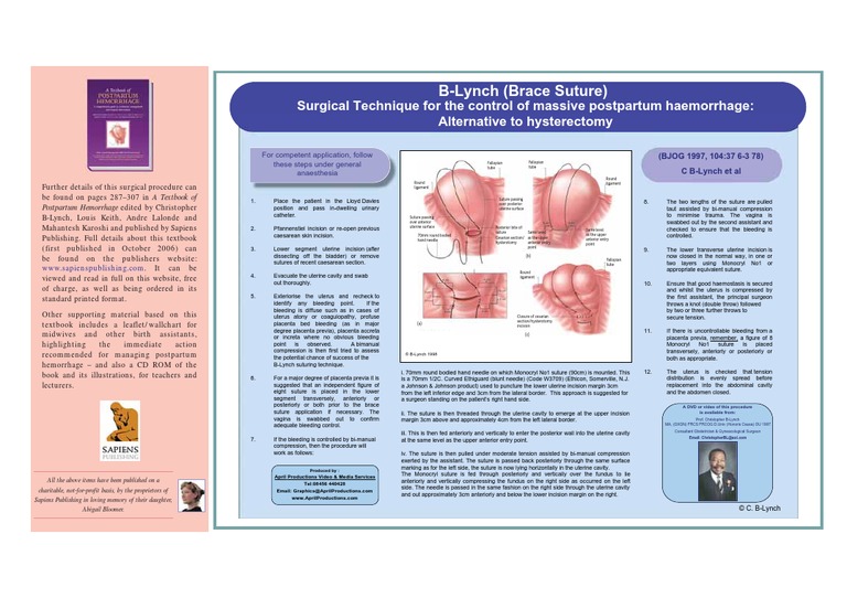 PPH Poster | Uterus | Surgical Suture